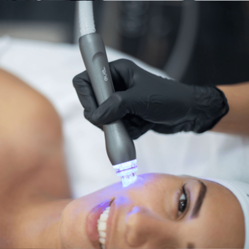 EVE Hydradermabrasion & Microcurrent Training Course